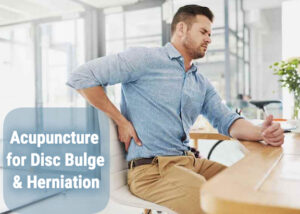 Acupuncture for Disc Bulge & Herniation: Can It Help You?