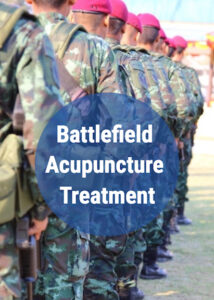 Battlefield Acupuncture Treatment & How It Works