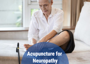 You Need This Treatment: Acupuncture for Neuropathy