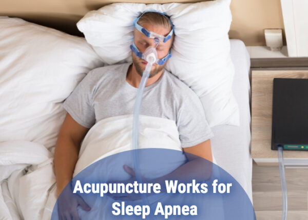 Acupuncture Can Help with Sleep Apnea